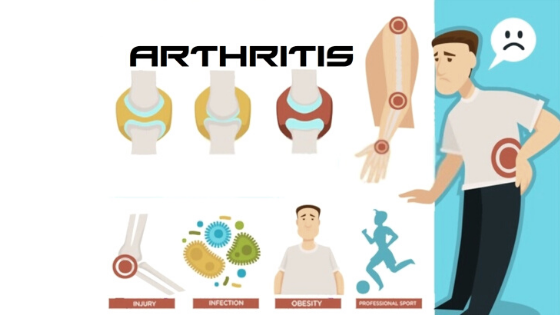 Facing the Challenge of Arthritis