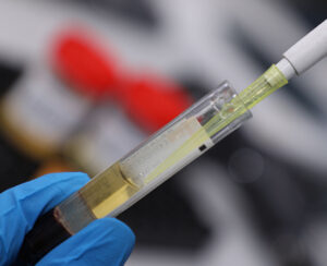 Does Diabetes Cause Urinary Tract Infections? Causes, Symptoms, and ...